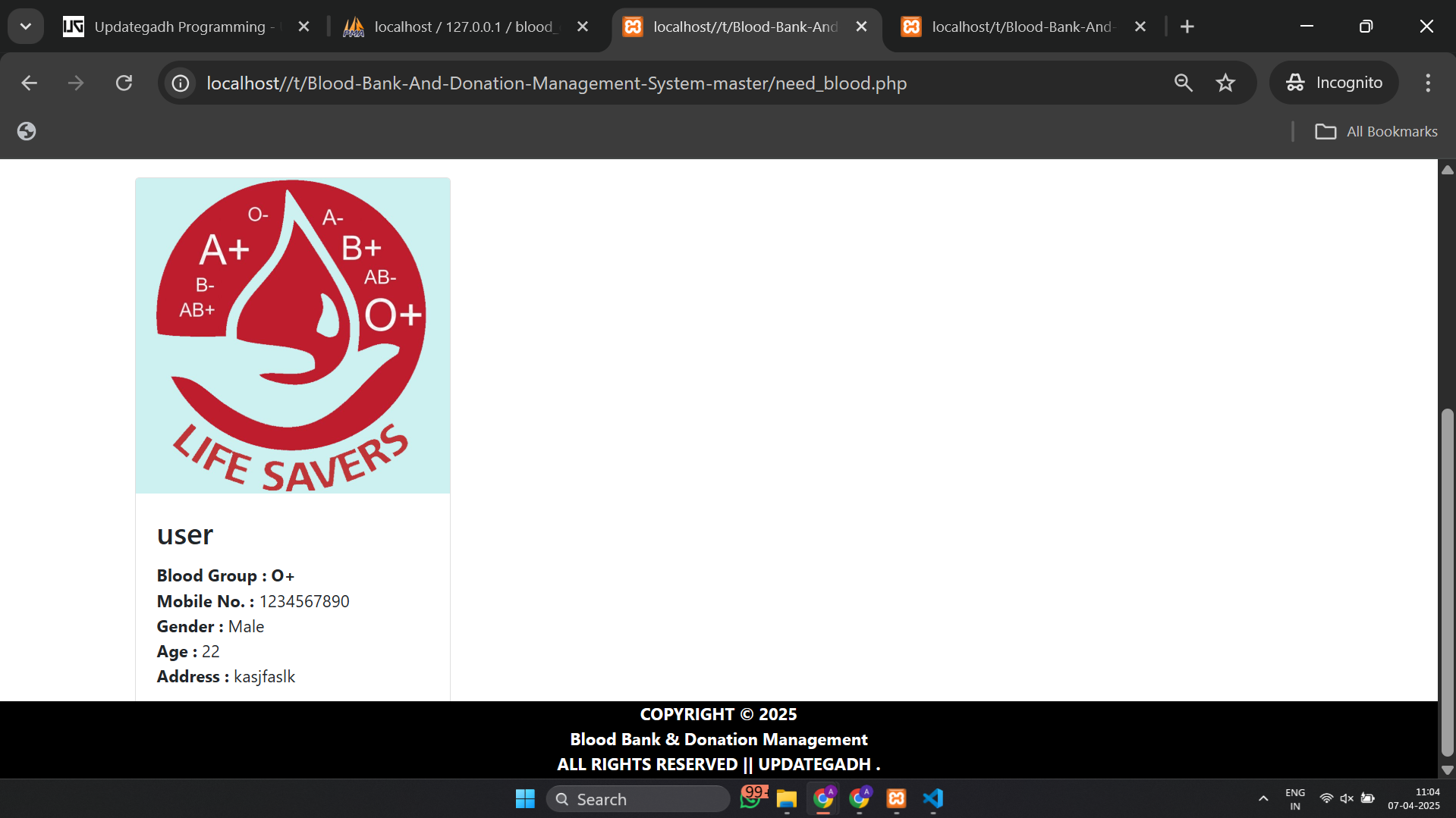 Blood Bank Management System in PHP with Source Code