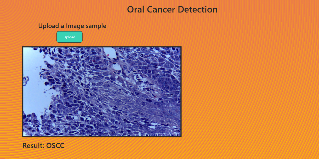 Best Oral Cancer Detection Using Deep Learning